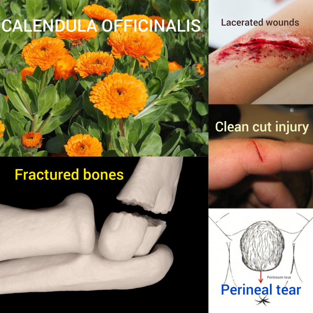 Remedies For Injuries Part 1 | Homeopathy Medicines | HDS